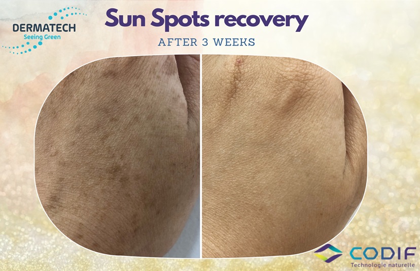 Dark Spot Recovery | Dermatech